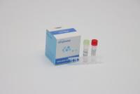 China Clinical Diagnosis IVD Real Time PCR Kit Fluorescence Probing One Step 20uL for sale