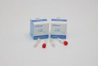 China CE PCR Swab Test Kit for Hepatitis B and C Clinical Diagnosis 20uL for sale