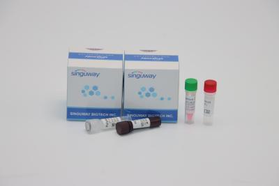 China Fluorescence Probing PCR Detection Kit Nasal Swab Sample For ADV Adenovirus Testing for sale