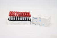 China CE Certified Viral Nucleic Acid Isolation Kit RNA DNA Extraction 1mL Tube for sale