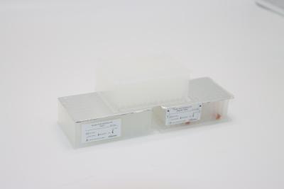 China CE Total RNA DNA Nucleic Acid Isolation Kit Supernatants 10 Copies / Ml for sale