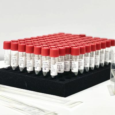 China Pharynx Nasal Swab Sample Release Reagent Extraction Kit 0.5mL/ Tube Without Preprocessing for sale
