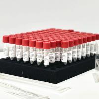 China Pharynx Nasal Swab Sample Release Reagent Extraction Kit 0.5mL/ Tube Without Preprocessing for sale