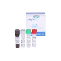 China Hepatitis B Virus DNA HBV Real Time PCR Kit Quantitative Diagnostic 30 IU/ML Sensitivity for sale