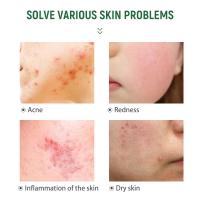 China GMP Acne Removal Tea Tree Cream Pimples And Dark Spot Remover for sale