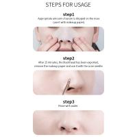 China Organic Blackhead Remover Peel Off Mask Serum 30ml Pore Cleaner OEM ODM for sale
