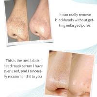 China Organic Blackhead Remover Peel Off Mask Serum 30ml Pore Cleaner OEM ODM for sale
