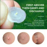 China Anti Wrinkle Hydrocolloid Pimple Patch Organic Waterproof Acne Treat for sale