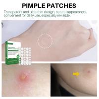 China Anti Wrinkle Hydrocolloid Pimple Patch Organic Waterproof Acne Treat for sale