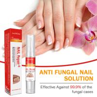 China GMP Nail Repair Pen for Damaged Fungal Infection Anti Fungal Treatment 10ml for sale