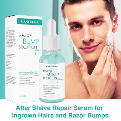 China 30ml After Shave Cream Serum Razor Bump Solution Beard Care for sale