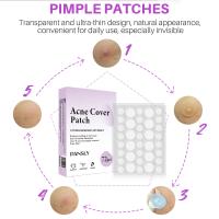 China Hydrocolloid Acne Pimple Patch Waterproof Treatment Acne Patches for sale