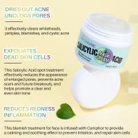 China Acne Scar Removal Face Cream with Salicylic Acid 50g Anti Acne Treatment Whitening Cream for sale