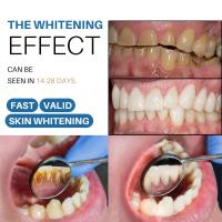 China Teeth Whitening Pen Cleaning Serum Instant Smile Kit 35ml Oral Hygiene Stain Remover for sale