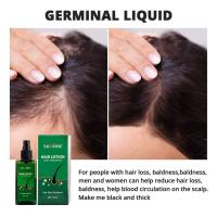 China GMP 120ml Hair Growth Spray Oil Lotion Treatment for Men with MSDS Certification for sale