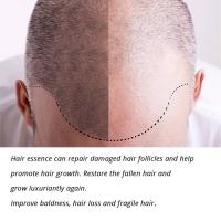 China GMP 120ml Hair Growth Spray Oil Lotion Treatment for Men with MSDS Certification for sale