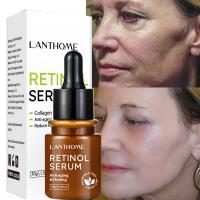 China Anti Aging Retinol Serum with Hyaluronic Acid Vitamin E 30ml Brightening Firming for sale
