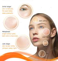 China MSDS Freckle Skin Care Face Cream 30g Anti Melasma Acne Spots Melanin Whitening for sale
