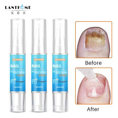 China Butanediol Fungal Nail Treatment Pen 4ml Anti Fungal Toenail Repair Essence for sale