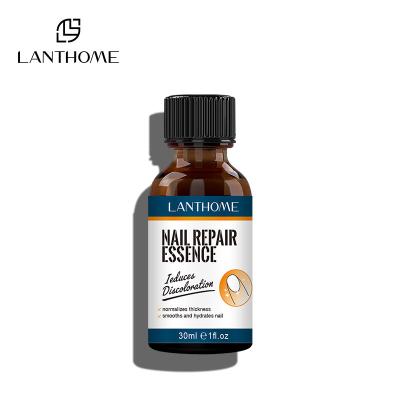 China Nail Repair Essence for Onychomycosis Paronychia 30ml OEM ODM Customizable for sale