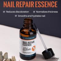 China Nail Repair Essence for Onychomycosis Paronychia 30ml OEM ODM Customizable for sale