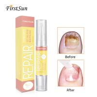China Glyceryl Nail Repair Essence Anti Fungal Nail Fungus Pen 3ml Treatment for sale