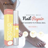 China Glyceryl Nail Repair Essence Anti Fungal Nail Fungus Pen 3ml Treatment for sale