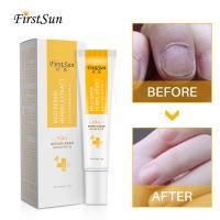China 15ml Petrolatum Nail Fungus Treatment Gel Repair Onychomycosis Anti-inflammatory for sale