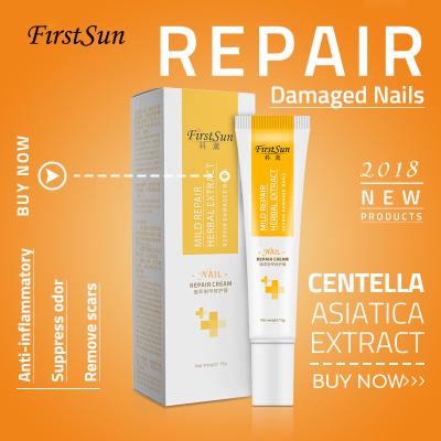 China 15ml Petrolatum Nail Fungus Treatment Gel Repair Onychomycosis Anti-inflammatory for sale