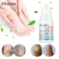 China Firstsun Borneol Nail Repair Treatment Gel Kills 99.9% Bacteria Fungus 10ml for sale