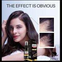 China Black Rice Extract Hair Growth Spray OEM ODM Stop Hair Loss 100ml for sale