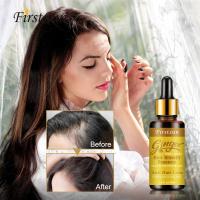 China Lanthome Ginger Hair Growth Essence 7 Days for sale