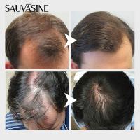 China Rice Water Hair Growth Serum 30ml Biotin Hair Care Loss Treatment Fast Improve for sale