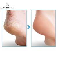 China Urea 40% Foot Crack Cream 50ml 50g for Dry Skin Soothes Softens Dead Skin Removal for sale