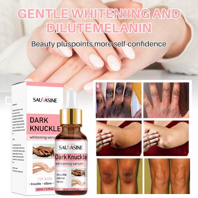 China 50ml Dark Knuckle Whitening Serum for Knees Elbows Skin Lightening Fade Melanin for sale
