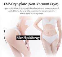 China EMS Electric Muscle Stimulation Weight Loss Machine 360 Degree Frozen For Slimming for sale