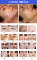 China Multifunctional Salon Facial Machine Hydrodermabrasion For Spa Skin Care OEM for sale