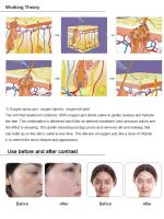 China Hydrodermabrasion Diamond Tips Spray Mist Gun  Bio  Oxygen Injector Ultrasonic Handle Skin Scrubber Pdt for sale