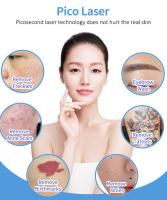 China 1200W Salon Laser Hair Removal Machine 2 In 1 Pico Laser 808 Wavelength for sale