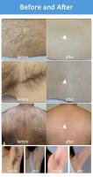 China Microblading Diode Professional Laser Machine Hair Removal Painless for sale