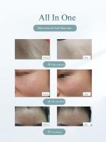 China Permanent Painless Beauty Salon Machine For Full Body Skin Hair Removal ODM for sale