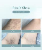 China Permanent Painless Beauty Salon Machine For Full Body Skin Hair Removal ODM for sale