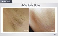 China Diode Laser 3 Wave Laser Machine , Hair Depilation Machine 808nm for sale