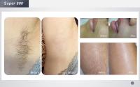China Diode Laser 3 Wave Laser Machine , Hair Depilation Machine 808nm for sale