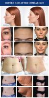 China Multifunctional  Body Slimming Machine Vacuum Polar RF Cavitation for sale