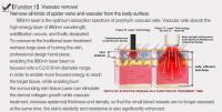 China Multipurpose 980 Nm Diode Laser , Vascular Removal Machine For Lipolysis Slimming for sale