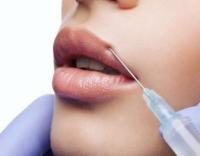 China Hyaluronic Acid Injection Gel Dermal Filler Syringe 1ml 2ml 5ml for Lip and Wrinkle Correction for sale