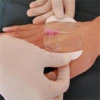 China CE OEM Breathable Semipermeable Transparent Film Dressing For Slight Abrasions for sale