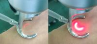 China 30W 40W 60W Fractional CO2 Laser Machine , Stationary CO2 Laser Vaginal Machine for sale