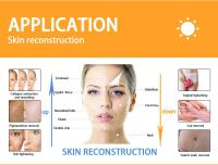 China 30W 40W 60W Fractional CO2 Laser Machine , Stationary CO2 Laser Vaginal Machine for sale